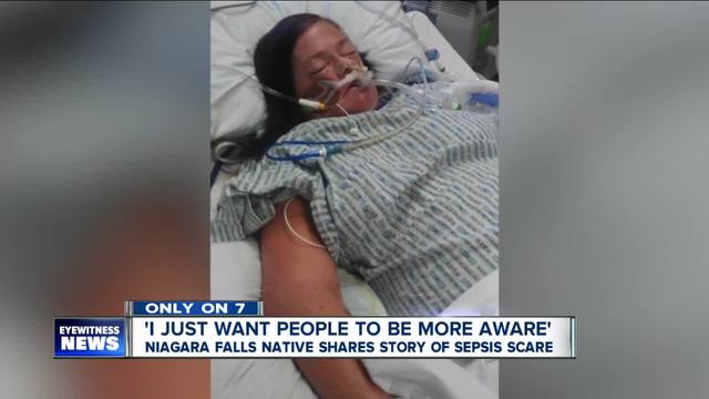 Niagara Falls native shares story of sepsis scare - WKBW.com Buffalo, NY